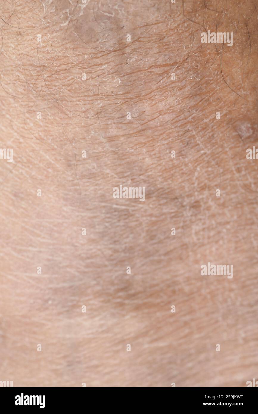 Skin texture close-up revealing details of surface and hair follicles ...