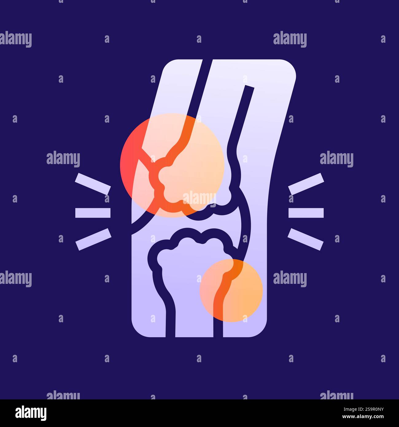 Rheumatoid arthritis line black icon. isolated button. Editable stroke ...