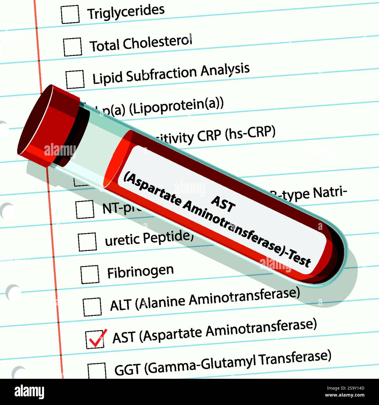Illustration of blood test tube and medical checklist Stock Vector ...