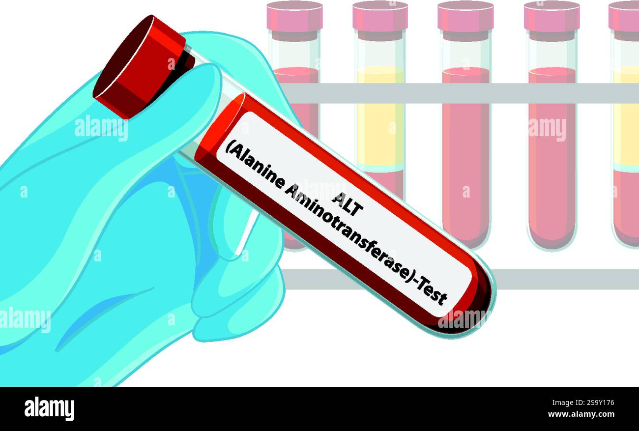 Hand holding blood sample for ALT test Stock Vector Image & Art - Alamy