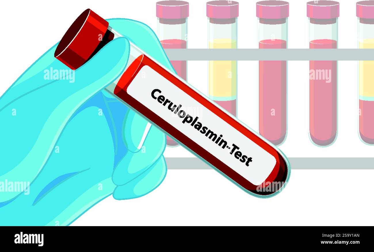 Hand holding a ceruloplasmin test tube Stock Vector Image & Art - Alamy