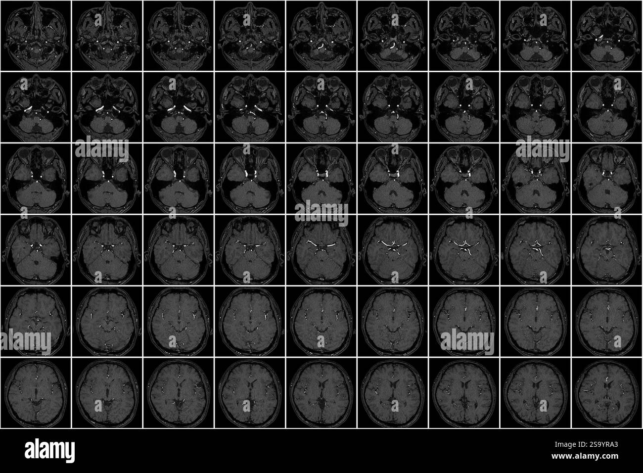 Thumbnail of head MRI Stock Photo - Alamy