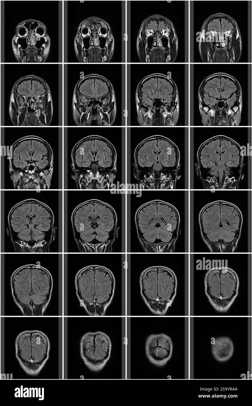 Scanning transmission x ray hi-res stock photography and images - Alamy