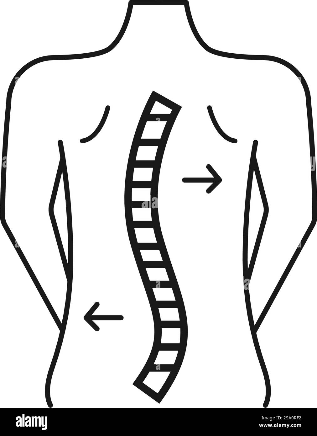 Spinal curvature correction with arrows hi-res stock photography and ...