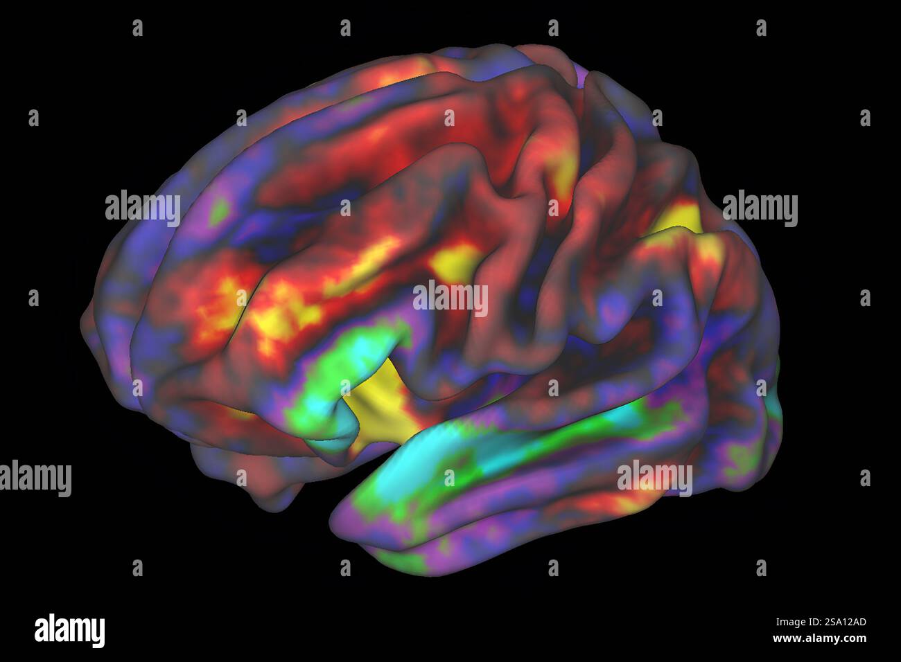 FMRI image of preteen brain while child performs a working memory task ...