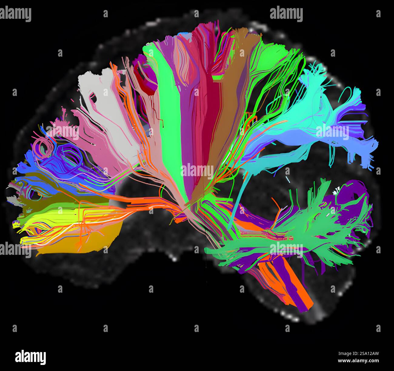 This High Angular Resolution Diffusion Image (HARDI) of the human brain ...