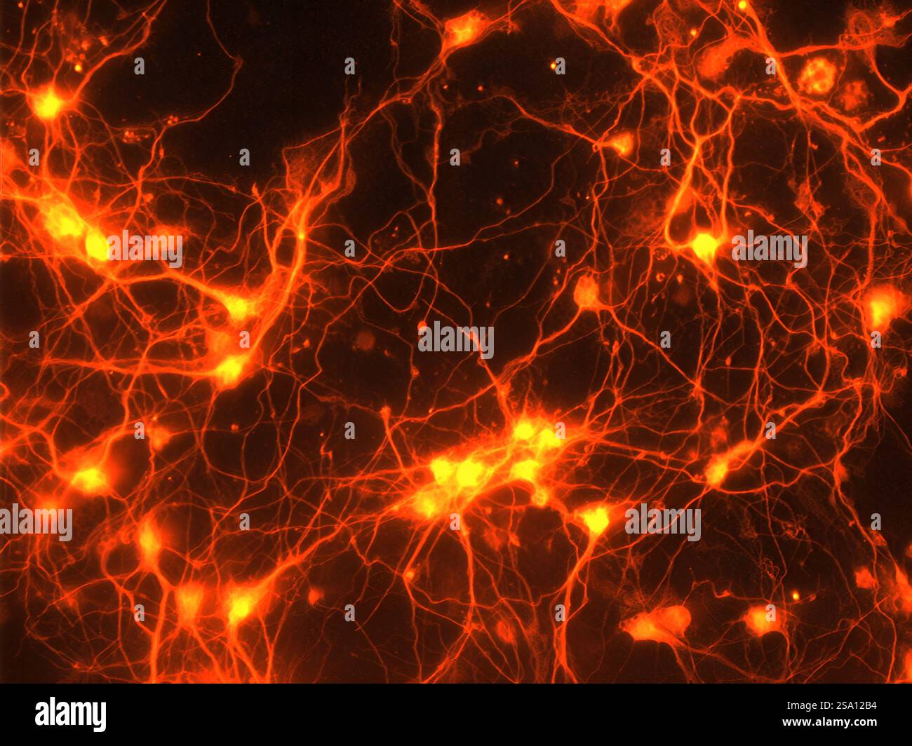 Sprouting connections in the brain: Adding GDF10 to neurons in a dish ...