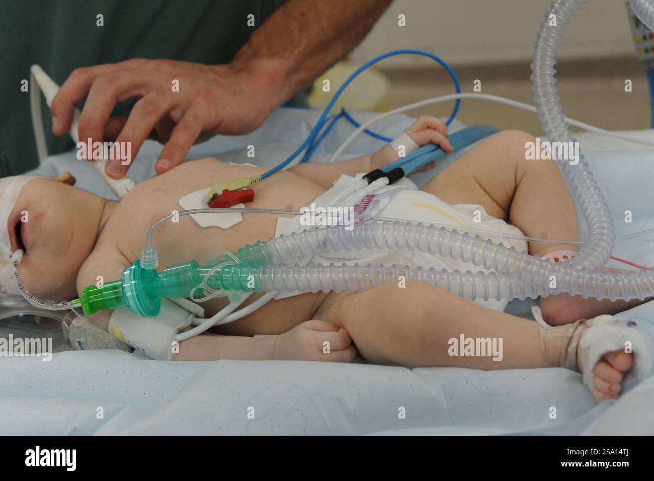 General anesthesia of a child in the operating room Stock Photo - Alamy