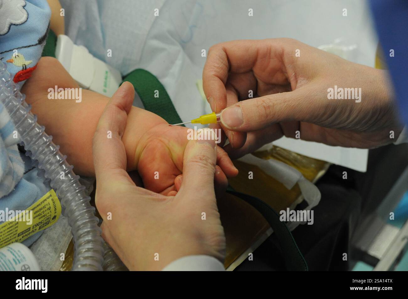 Anesthesia of a child operating hi-res stock photography and images - Alamy