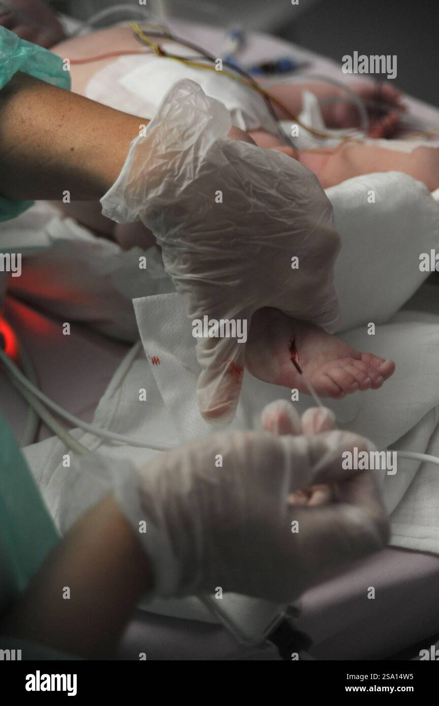 General anesthesia of a child in the operating room Stock Photo - Alamy