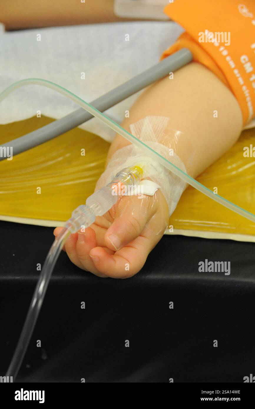 General anesthesia of a child in the operating room Stock Photo - Alamy