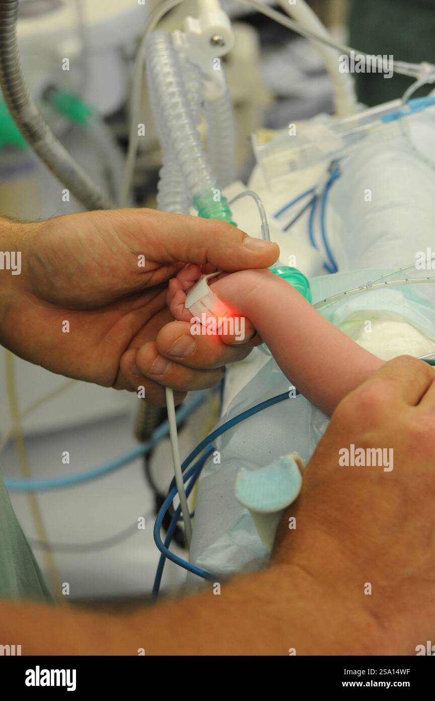 General anesthesia of a child in the operating room Stock Photo - Alamy