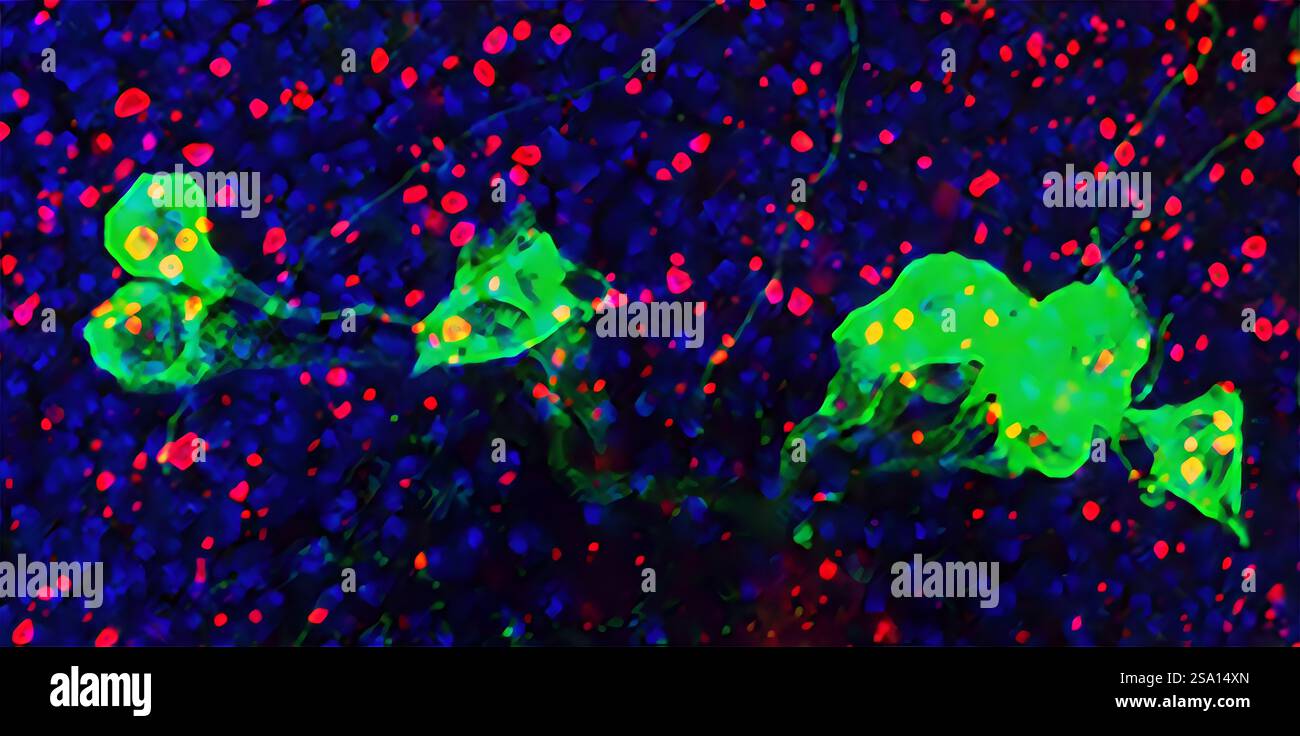 In a study of flies, NIH scientists showed how the immune system may be ...