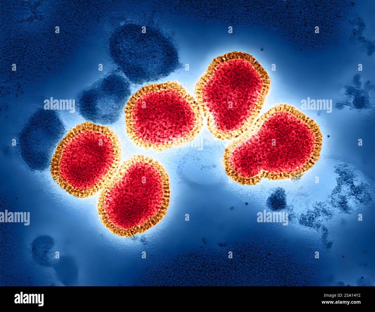 Colorized transmission electron micrograph of influenza A virus ...