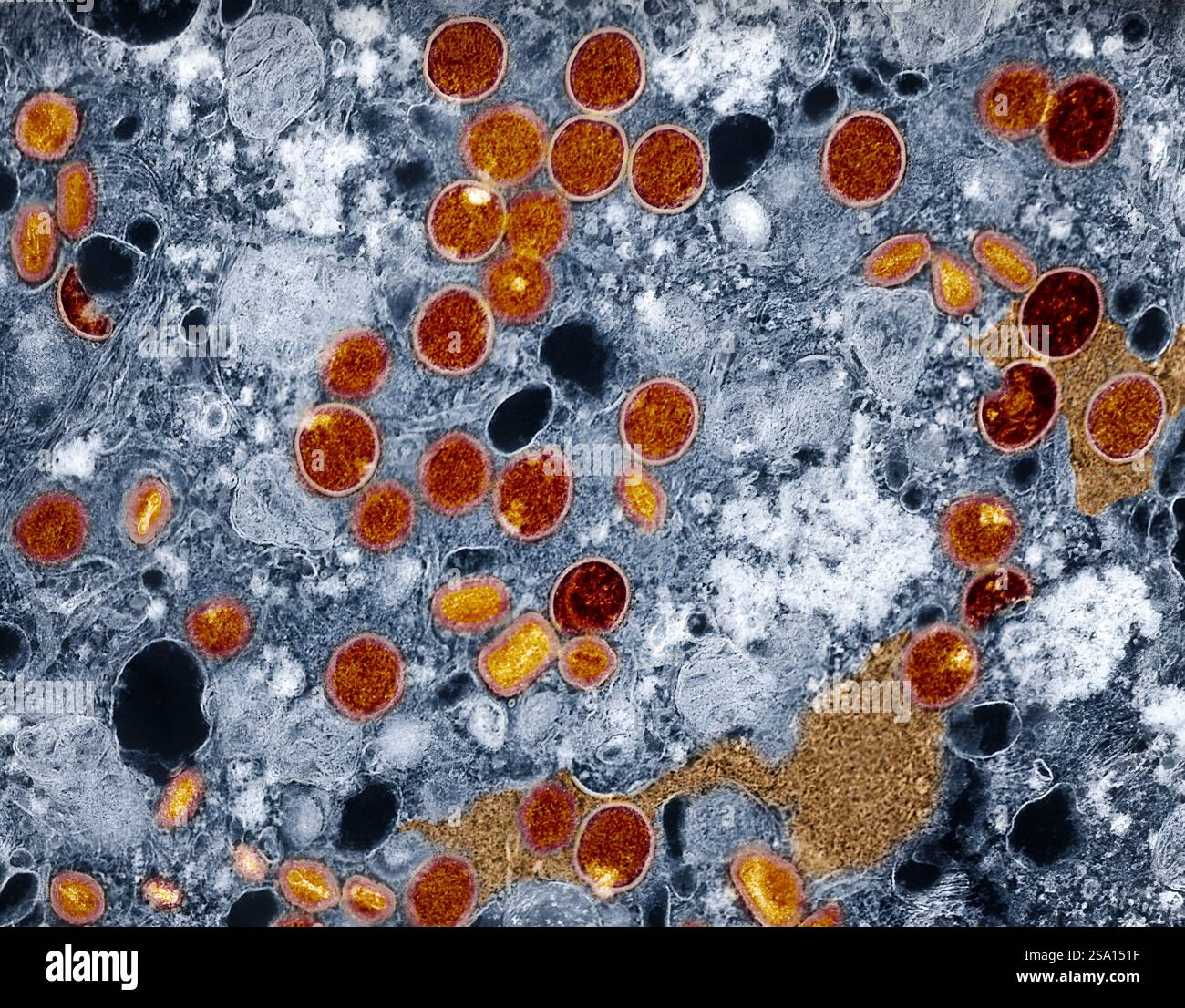 Colorized transmission electron micrograph of mpox virus particles (red ...