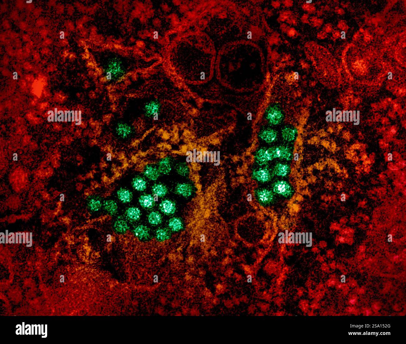 Transmission electron micrograph of dengue virus particles (green ...