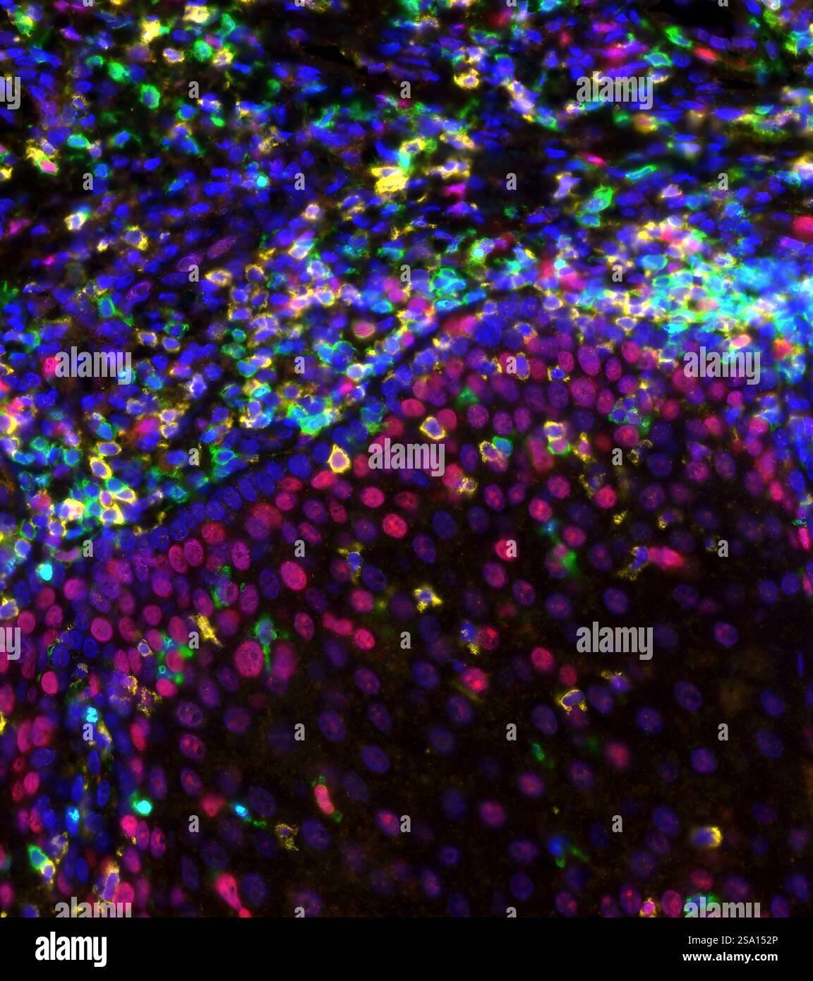 A new study may explain why treating head and neck cancers with the ...