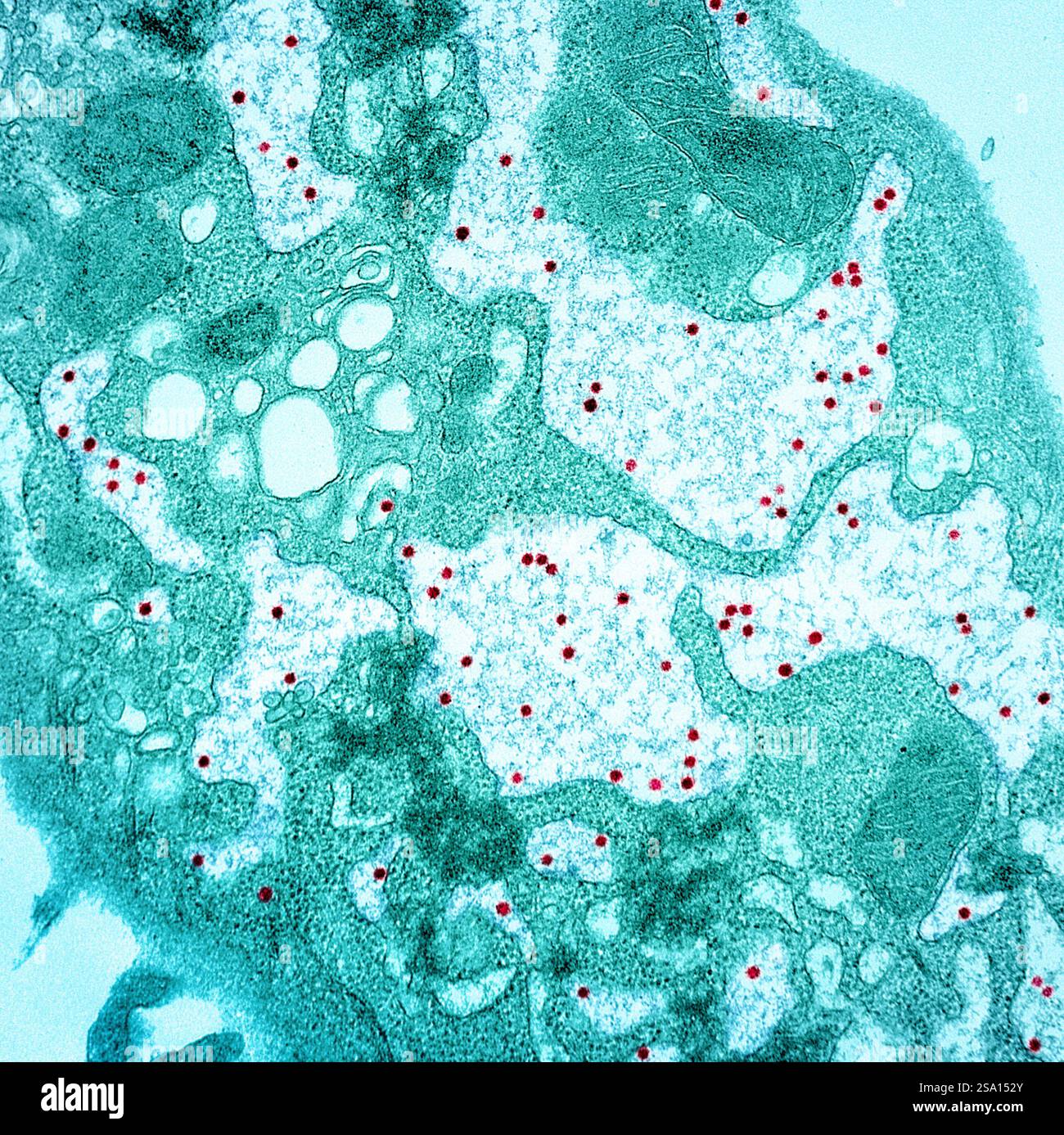 Colorized transmission electron micrograph of yellow fever virus ...