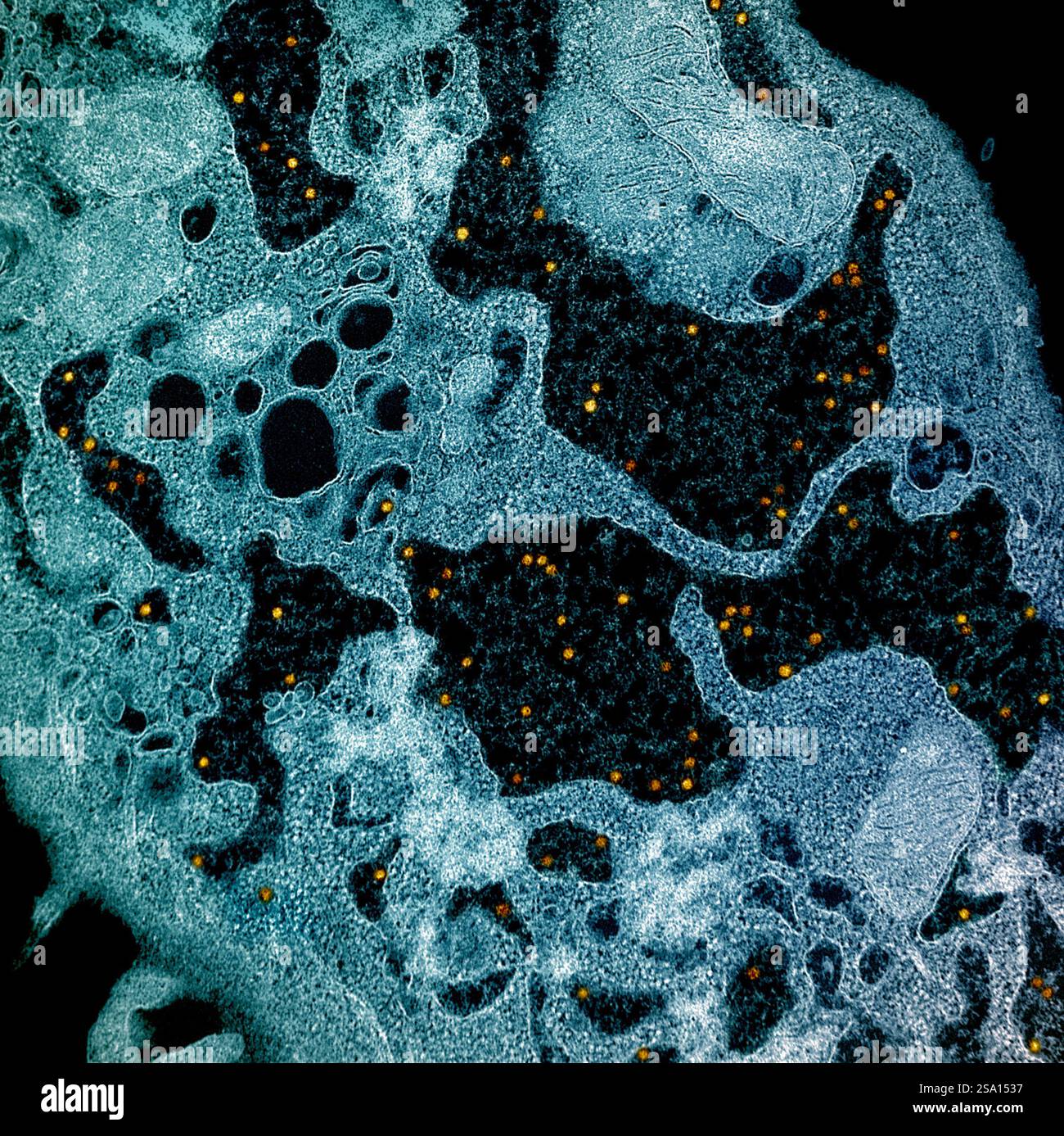 Colorized transmission electron micrograph of yellow fever virus ...