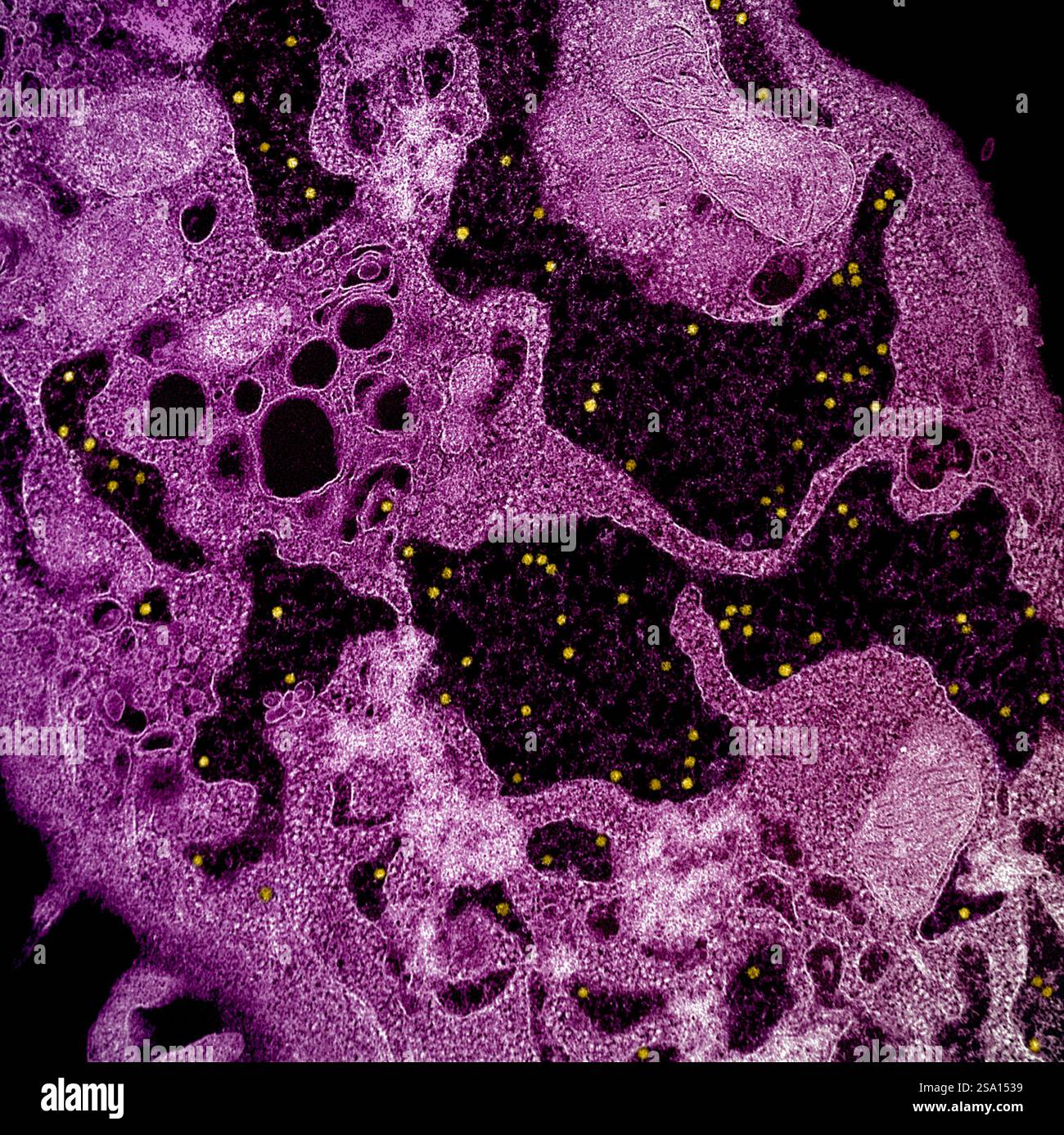 Colorized transmission electron micrograph of yellow fever virus particles (yellow) found within ...