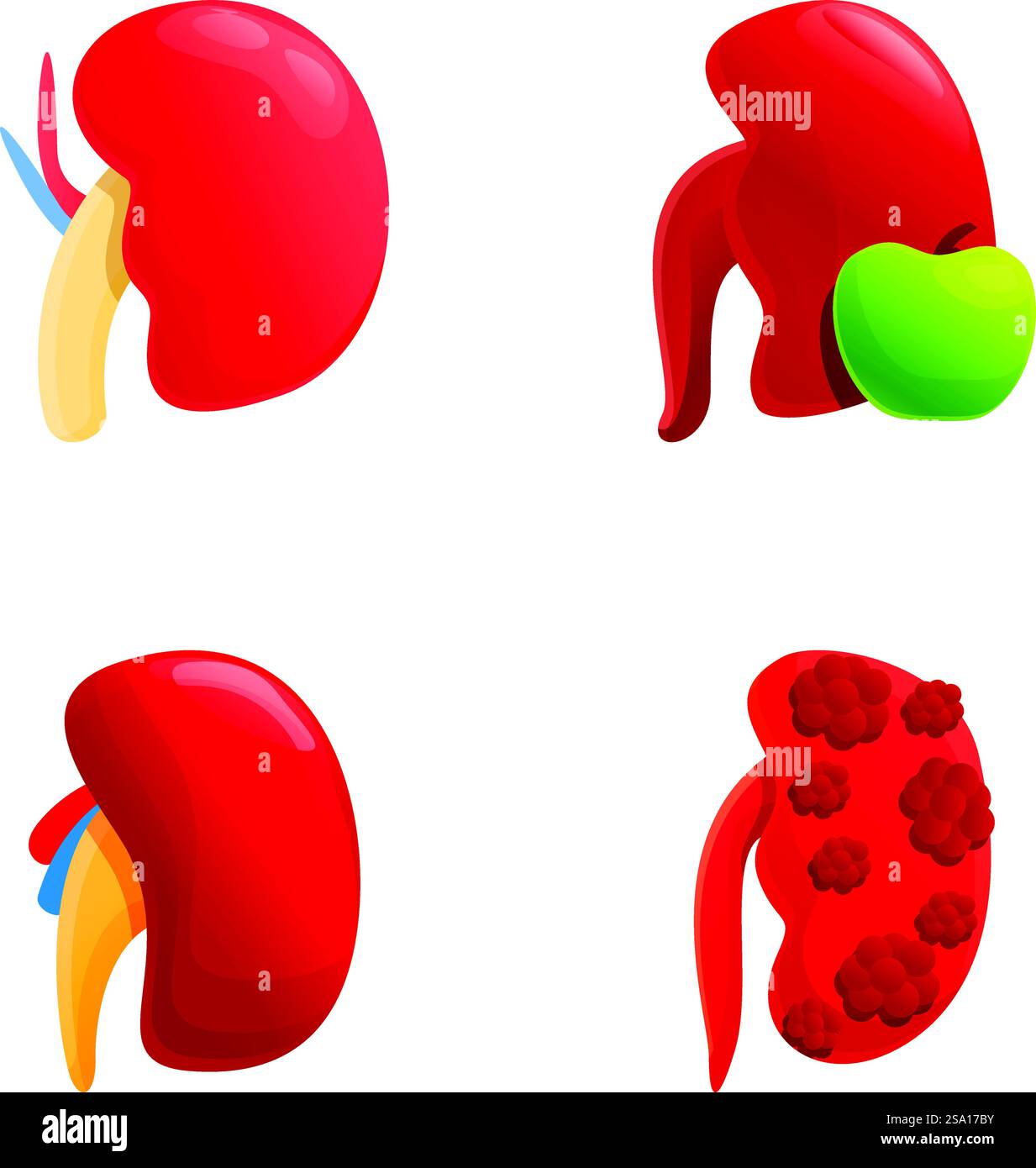 Kidney disease icons set cartoon vector. Human kidney model with ...