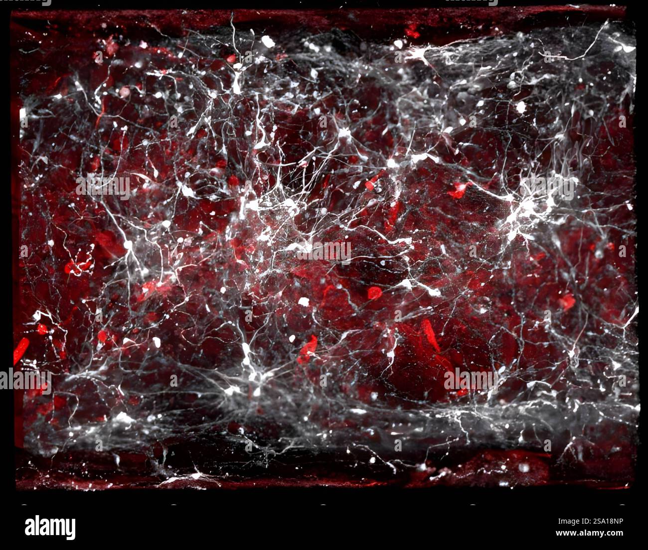 Vasculature cells and dopamine-producing neurons of the human brain ...