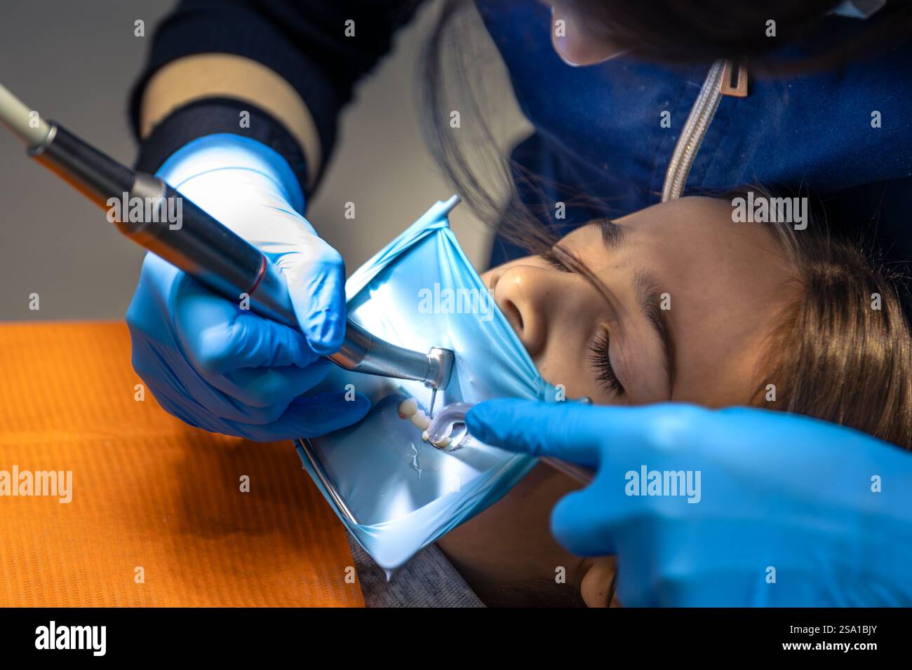 The dentist treats the child's tooth using a rubber dam. Close-up of ...