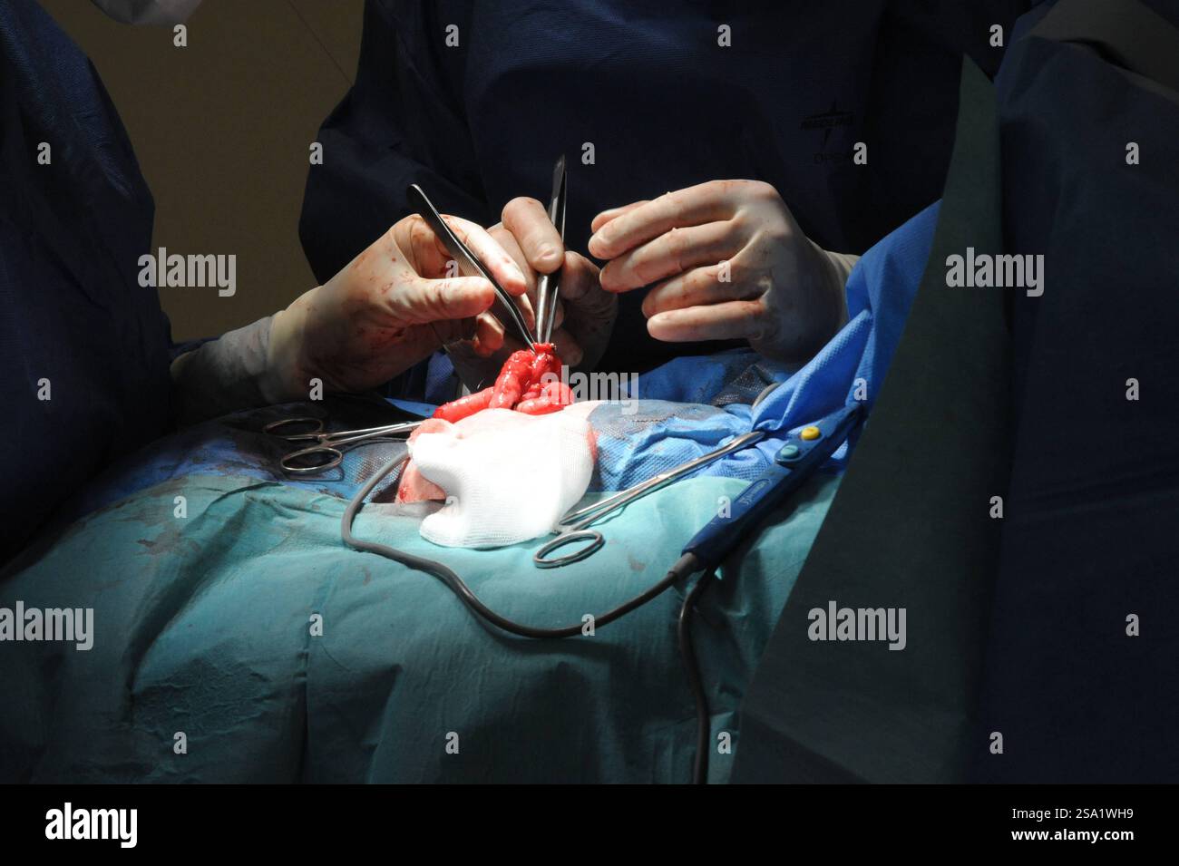 Operating room in pediatric surgery on a child. Pediatric surgery ...