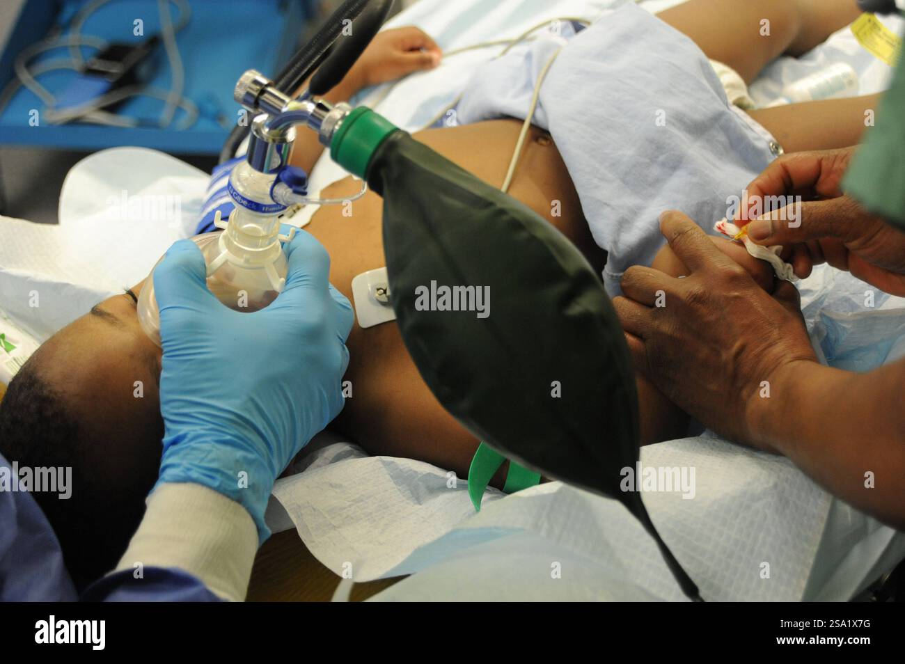 General anesthesia of a child in the operating room. Child anesthesia ...