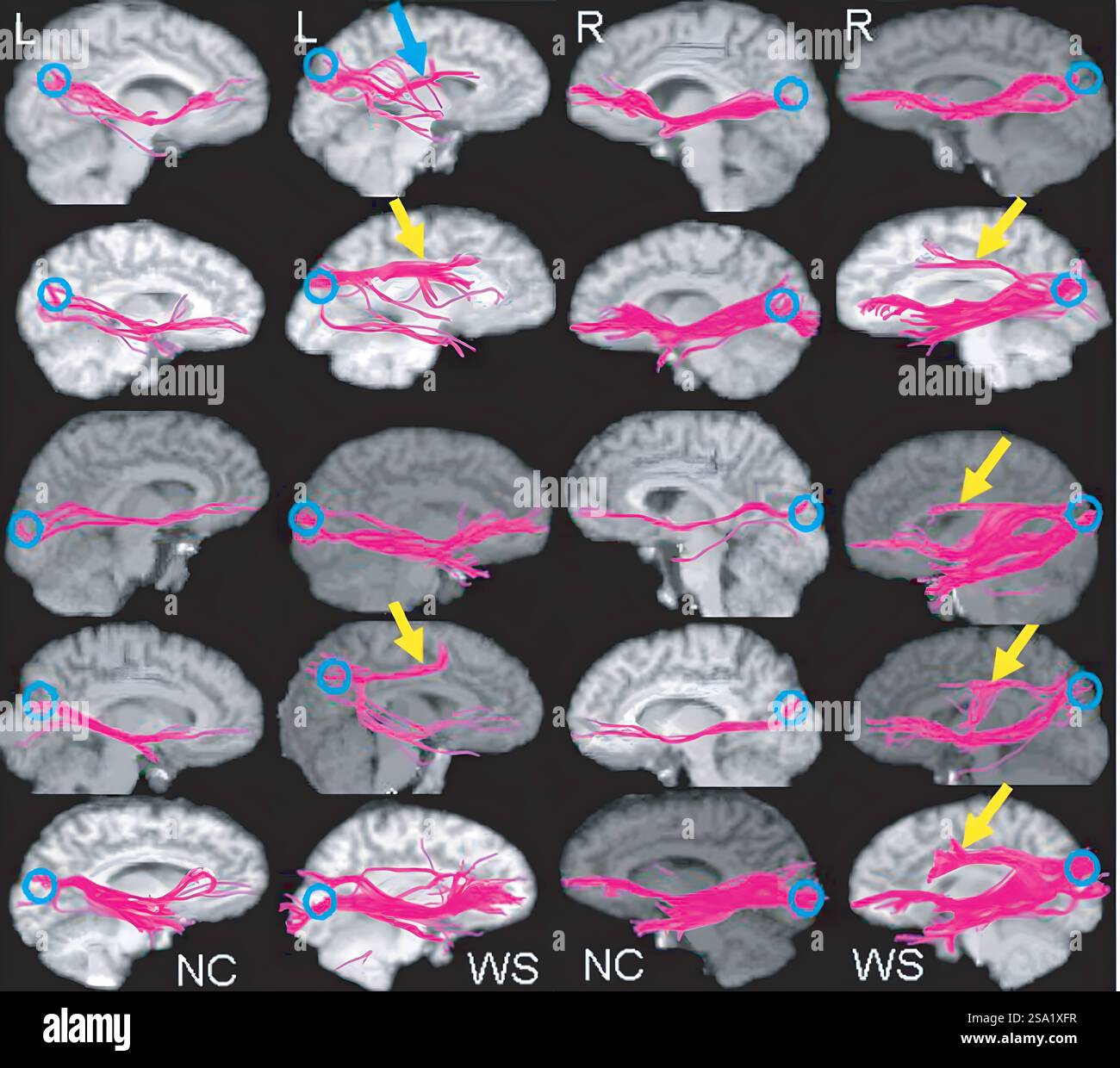Small images of the left and right half of the human brain Credit ...