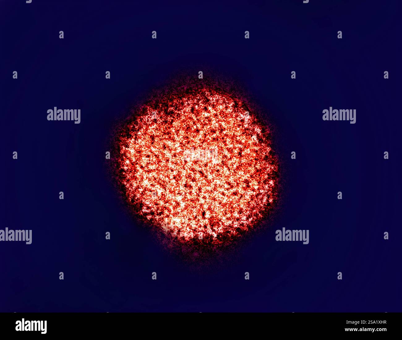 Colorized transmission electron micrograph of a hepatitis C virion ...