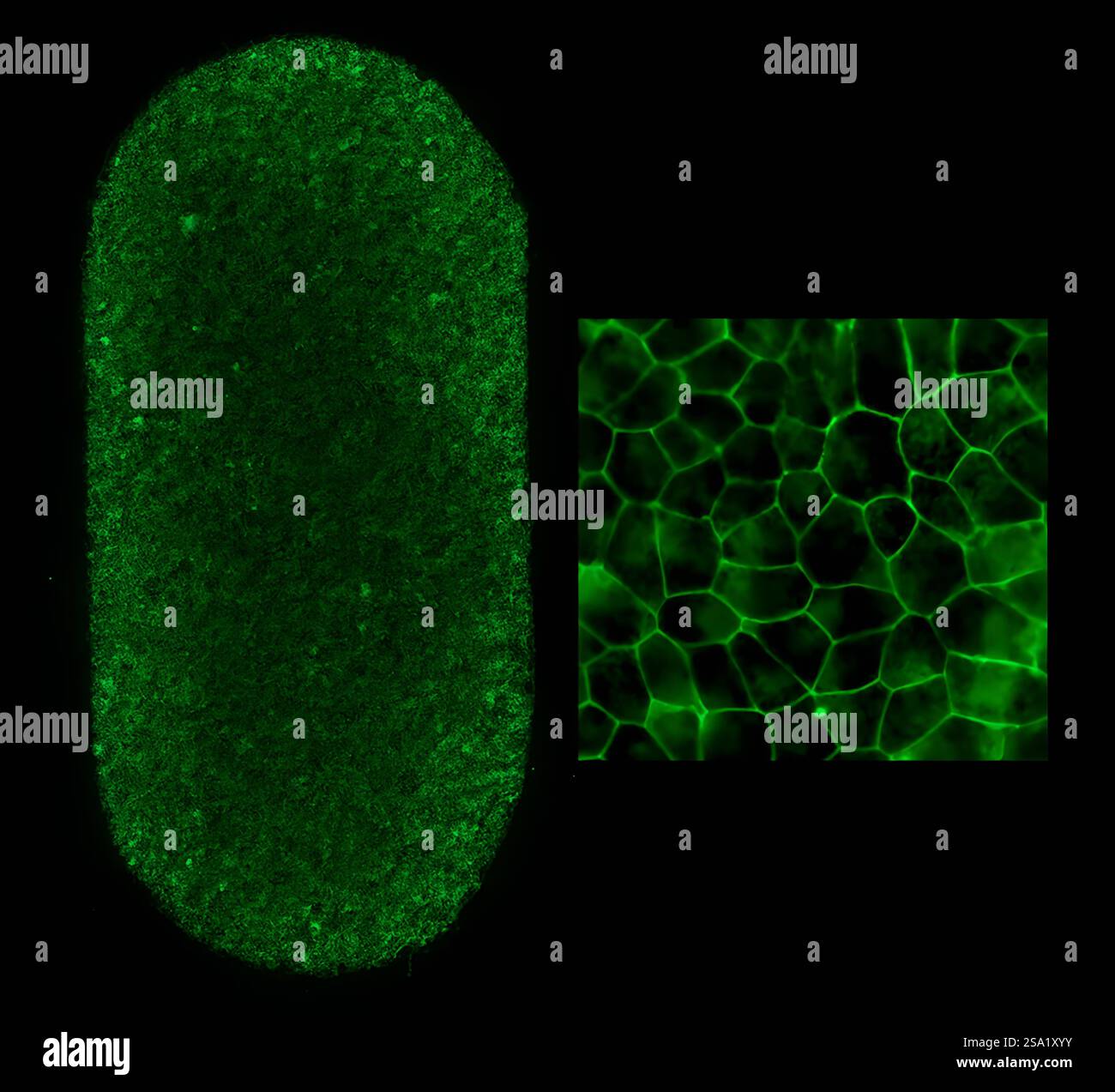 An NIH surgical team successfully implanted a patch of tissue made from ...