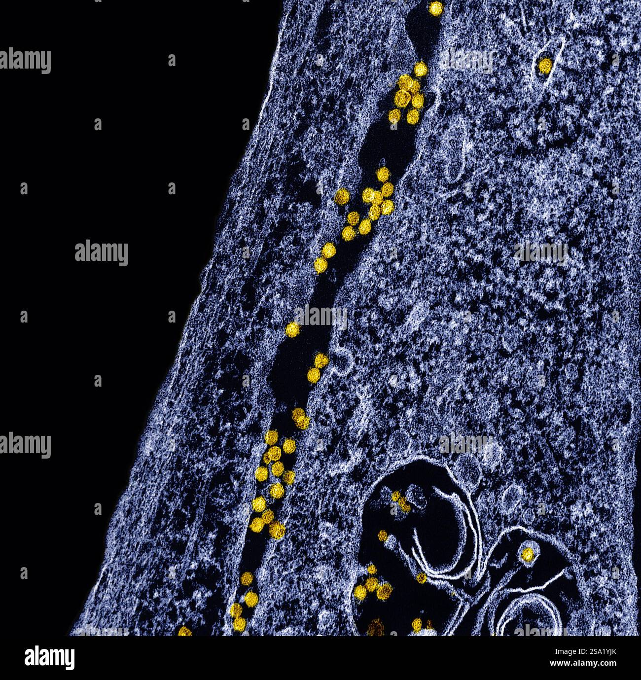 Transmission electron micrograph of West Nile virus particles yellow ...