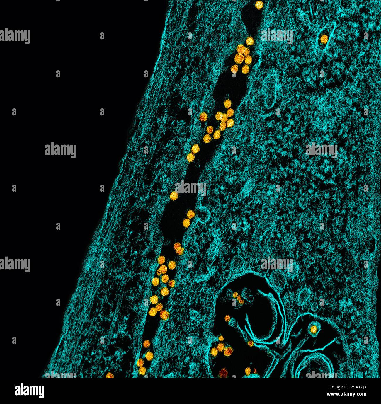 Transmission electron micrograph of West Nile virus particles yellow ...
