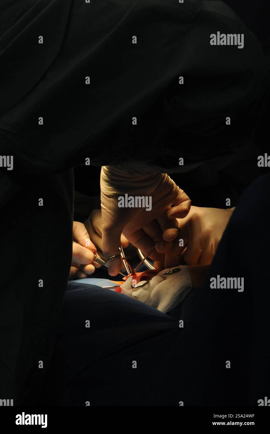 Operating room in pediatric surgery on a child. Pediatric surgery ...