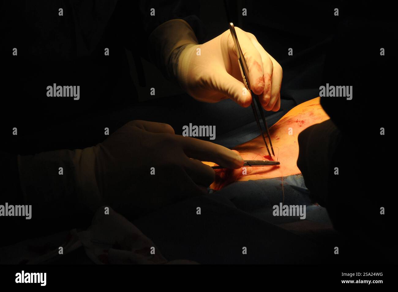 Operating room in pediatric surgery on a child. Pediatric surgery ...