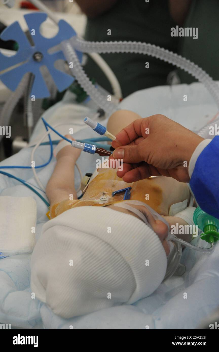 General anesthesia of a child in the operating room. Child anesthesia ...