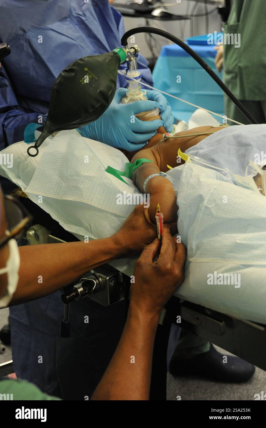 General anesthesia of a child in the operating room. Child anesthesia ...