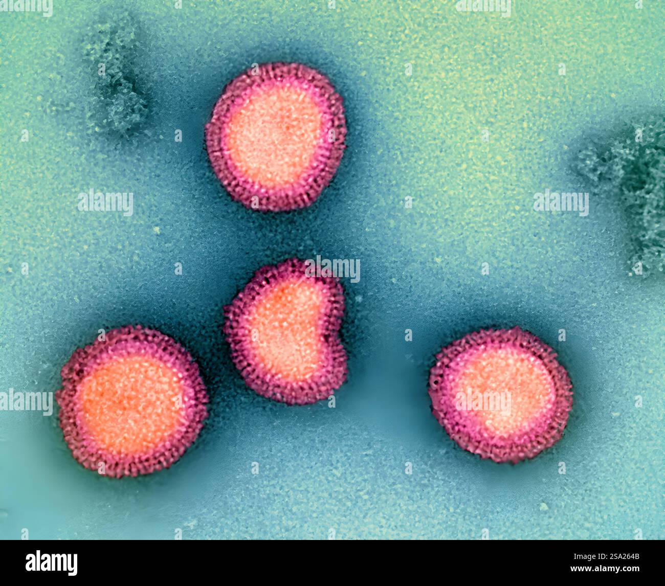 Influenza B virus particles, colorized orange and pink, isolated from a ...