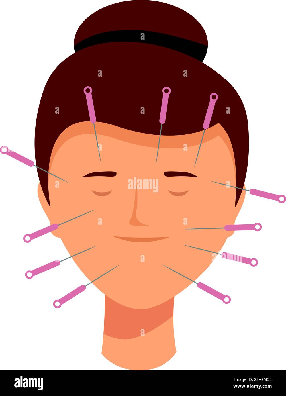 Illustration of acupuncture therapy, traditional chinese medicine for ...