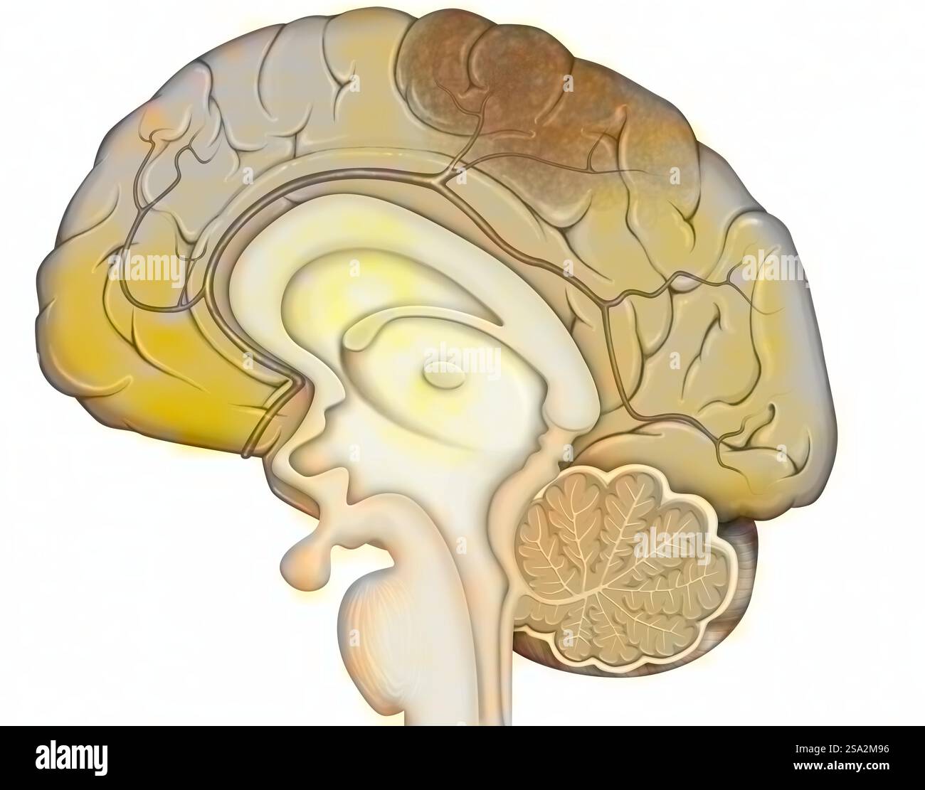 Hematoma hemorrhage hi-res stock photography and images - Alamy