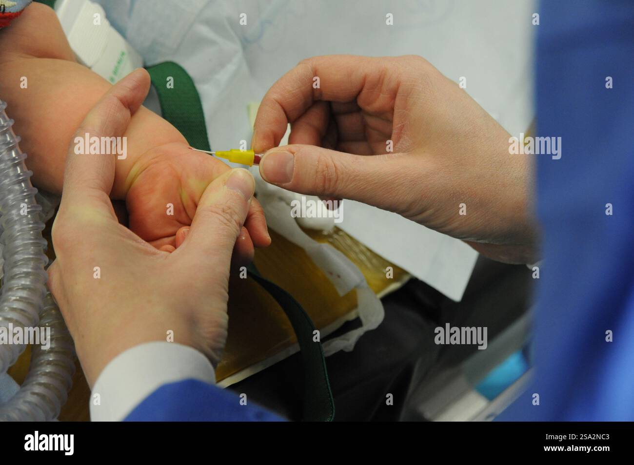 General anesthesia of a child in the operating room Stock Photo - Alamy