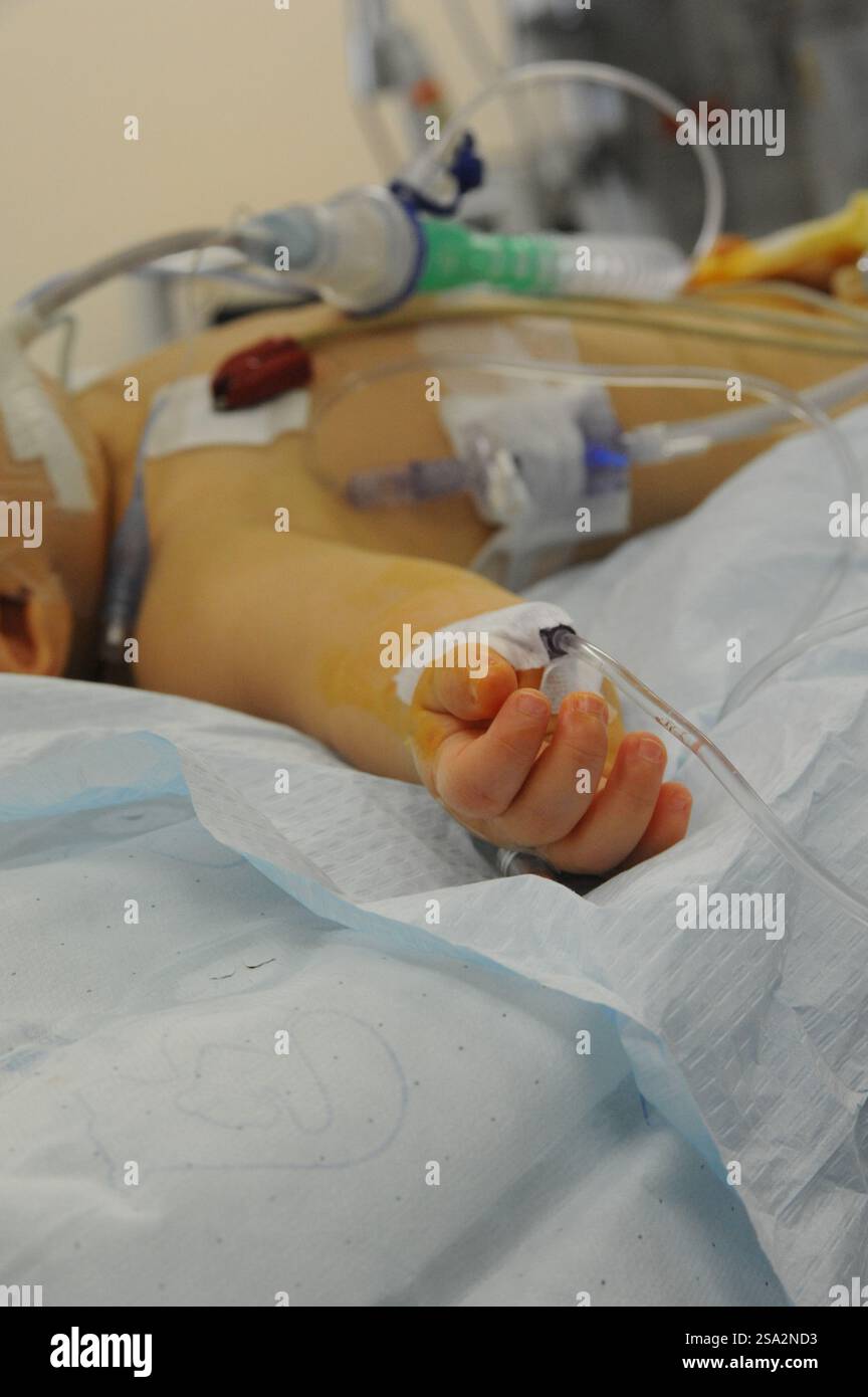 General anesthesia of a child in the operating room Stock Photo - Alamy