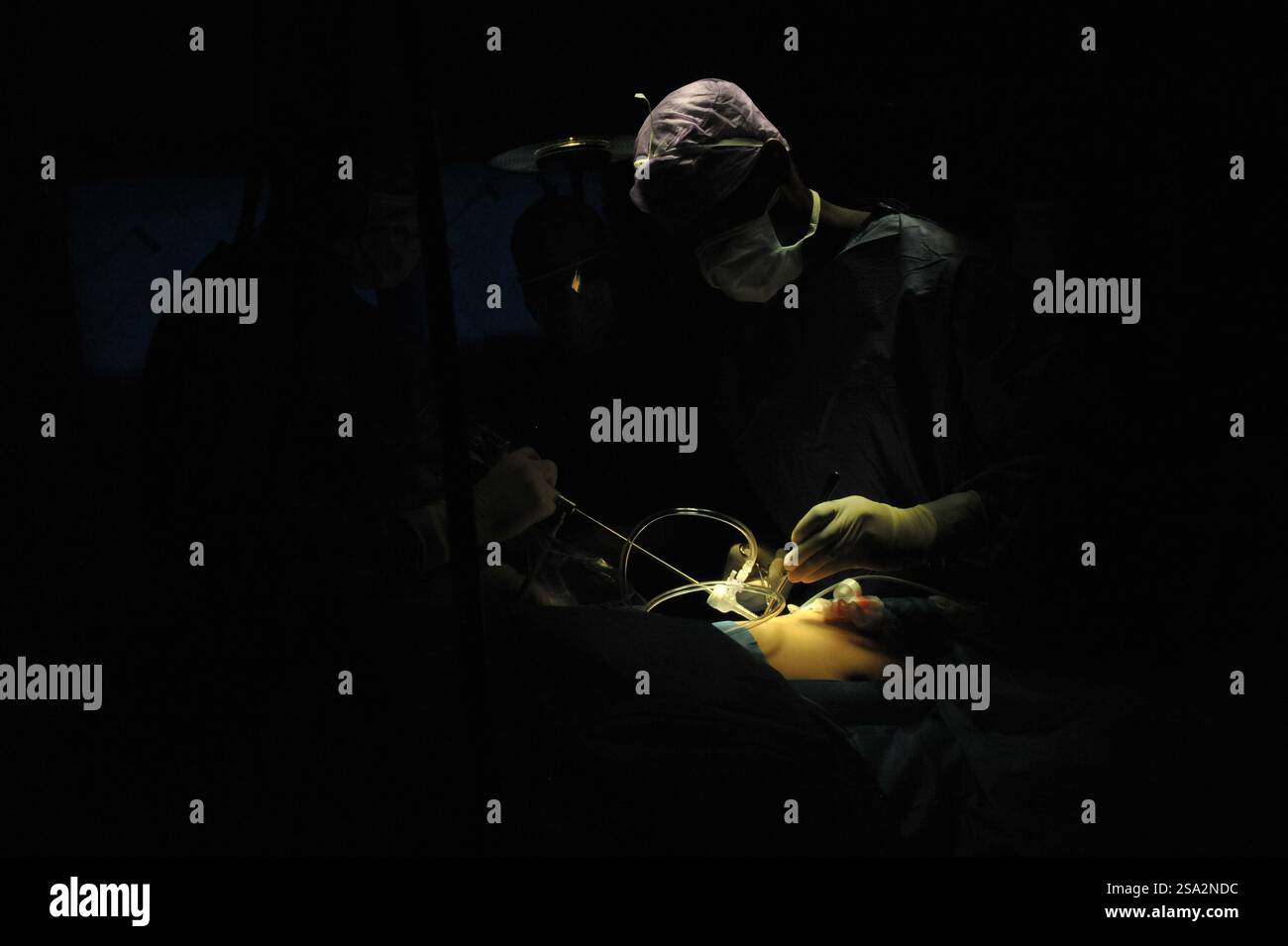 Operating room in pediatric surgery on a child Stock Photo - Alamy