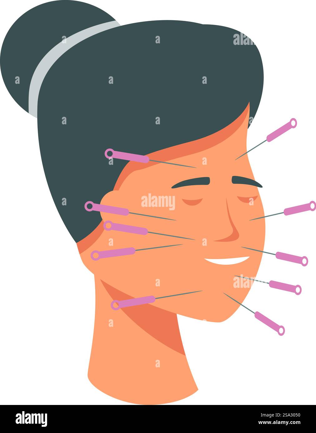 Acupuncture therapy illustration with vector design for alternative ...