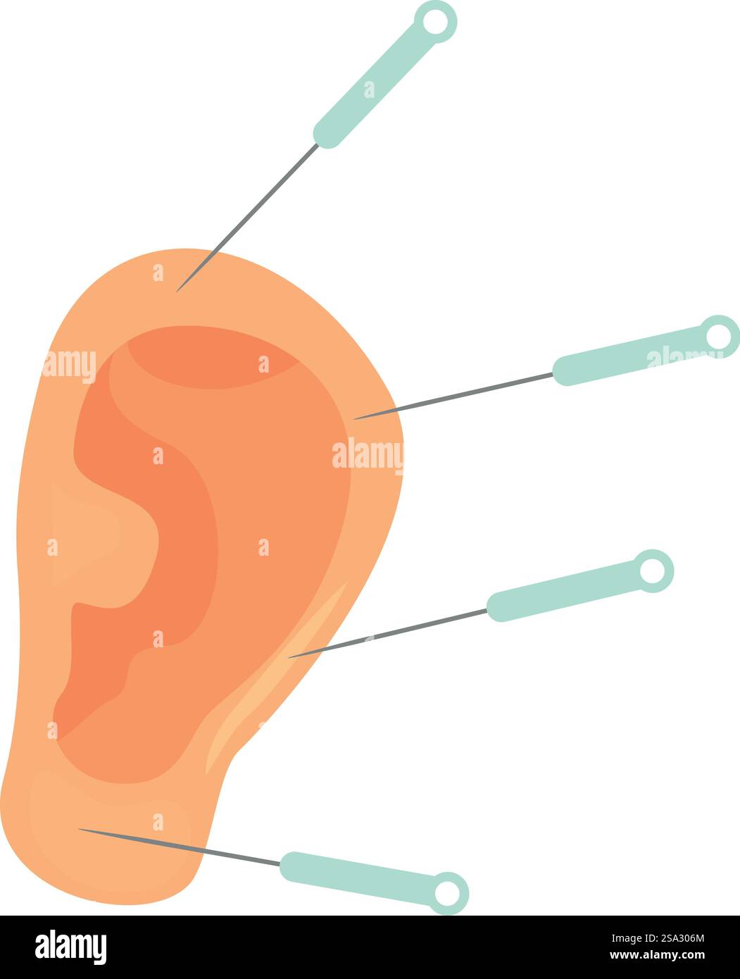 Illustrated vector acupuncture therapy concept with ear, needles, and ...