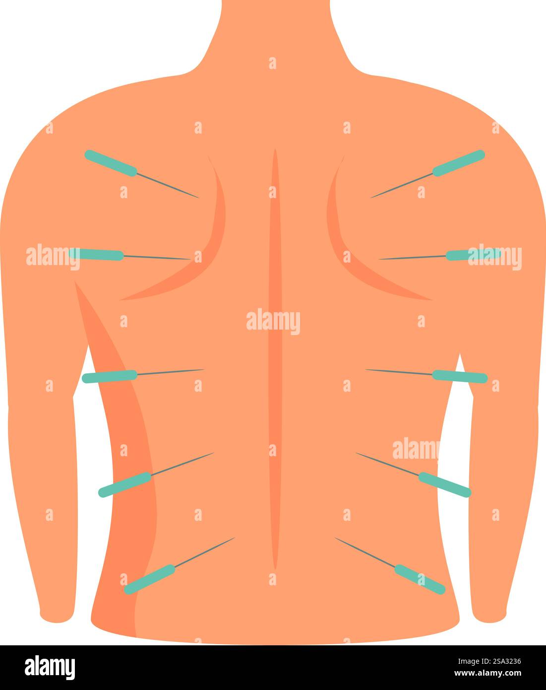Holistic acupuncture therapy illustration for alternative back pain relief with traditional ...