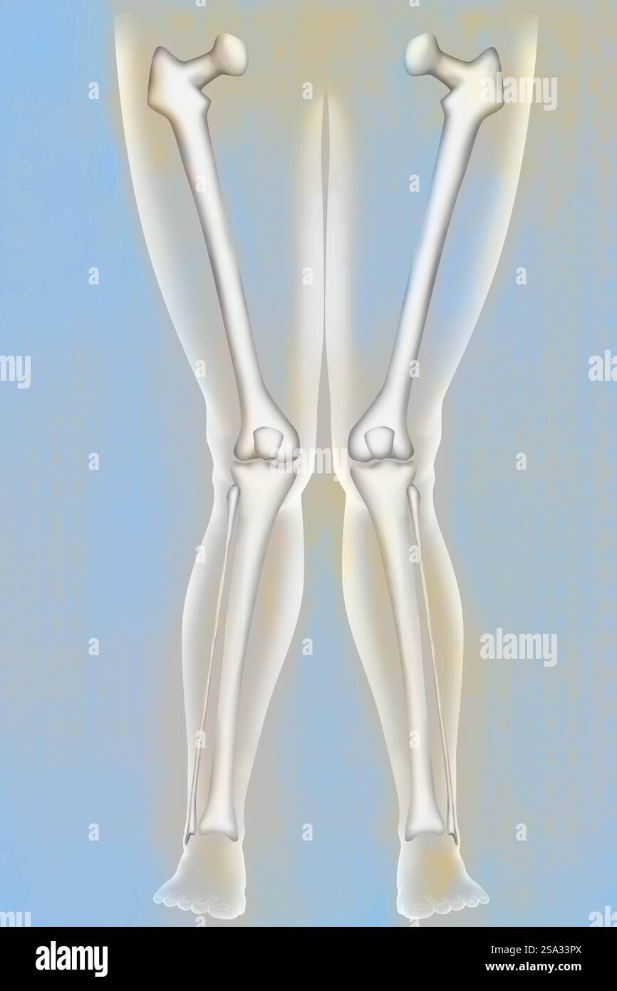 Knock knee hi-res stock photography and images - Alamy