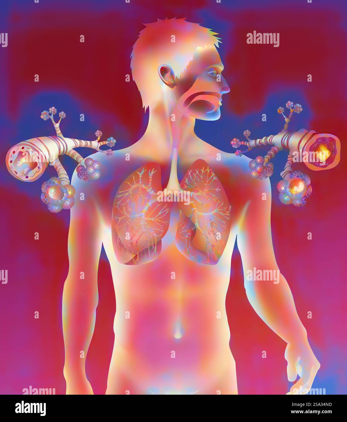 Depiction of a healthy bronchial tube left and a bronchial tube during ...