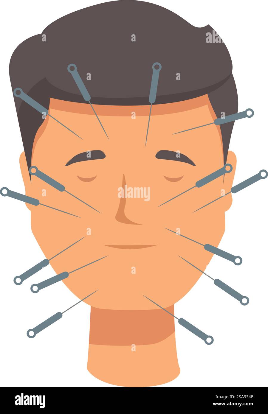 Illustration of acupuncture therapy concept with a vector graphic ...